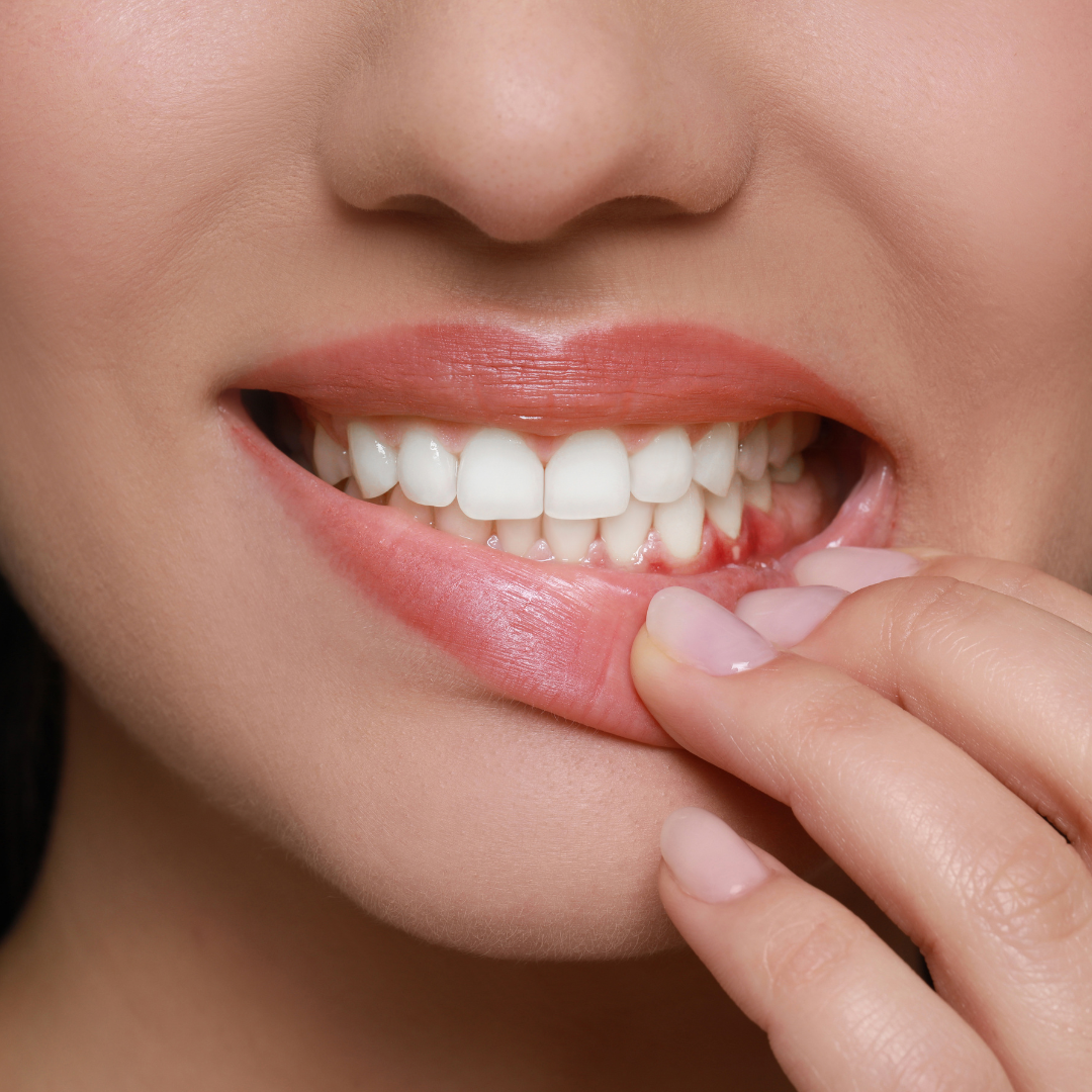 How Summer Treats Impact Your Teeth & Gums